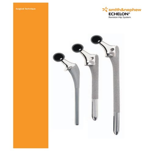 Protesis echelon revision st | PDF