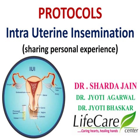 Ovum pick up (opu) | PPTX