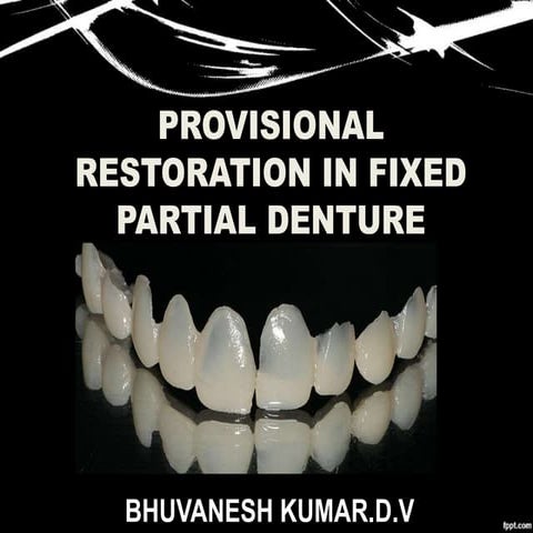 Provisional restoration in fixed partial denture | PPTX