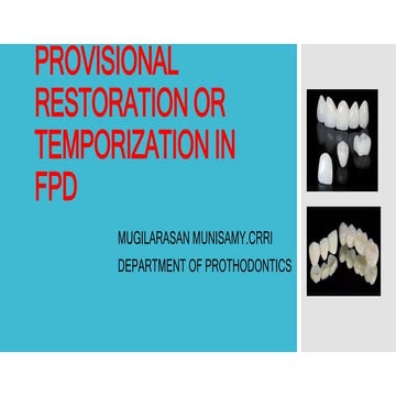 Temporization in fixed prosthodontics | PPTX