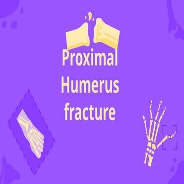 nenenenennenenenenen-humerus-fracture.pptx