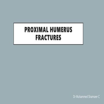 ICD10 Cheat Sheet Common Fractures | PDF