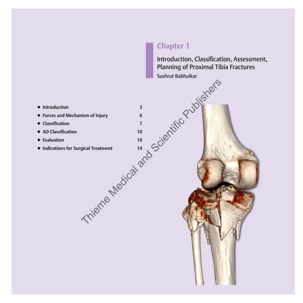 Guidelines in Fracture Management - Proximal Tibia by Babhulkar | PDF