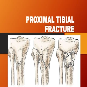 Proximal Tibia Anatomy