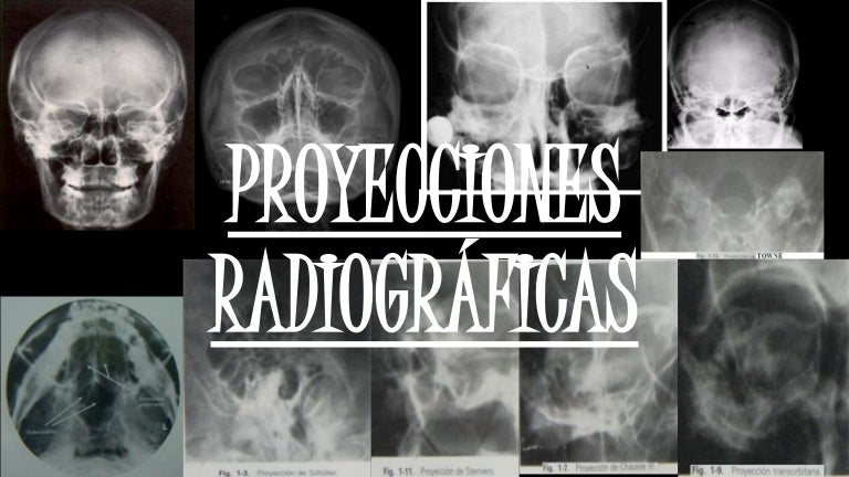 PROYECCIONES RADIOGRÁFICAS DE CRANEO