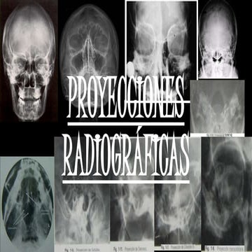 Posiciones radiográficas y proyecciones radiológicas | PDF