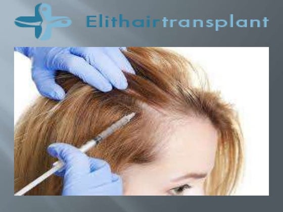 Prp behandlung berlin | PPT