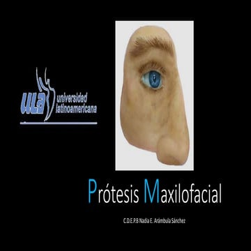 Prótesis maxilofacial | PPTX