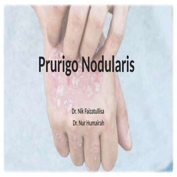 Prurigo Nodularis the basic knowledge for non dermatologist | PPTX