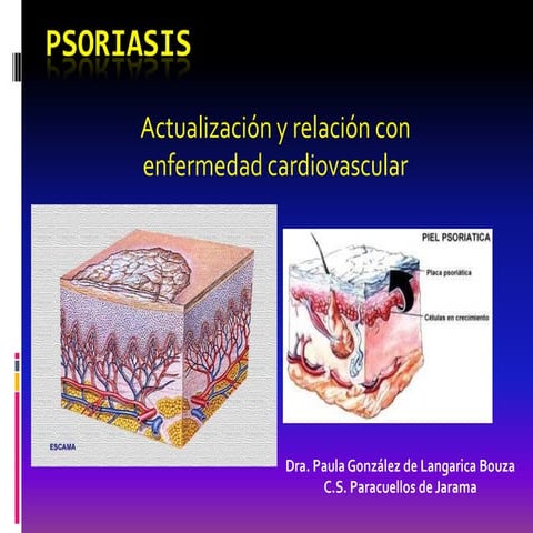 Psoriasis. Lourdes Sanchez. | PDF