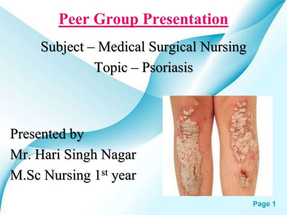Psoriasis | PPT