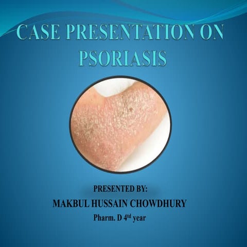 Case Presentation on Psoriasis | PPTX
