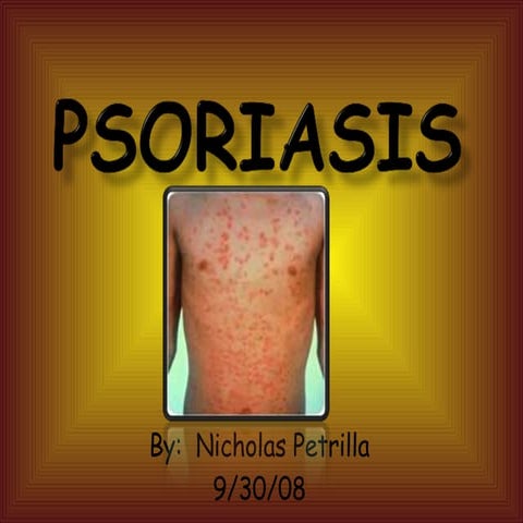 Psoriasis | PPT