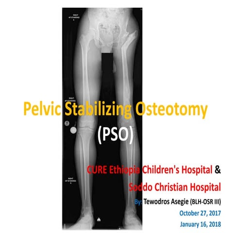 Pso t. asegie | PPTX