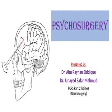 Comprehensive Overview of Psychosurgery: History, Techniques, and ...