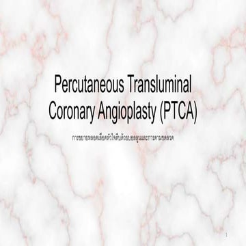 (Ptca) | PPT