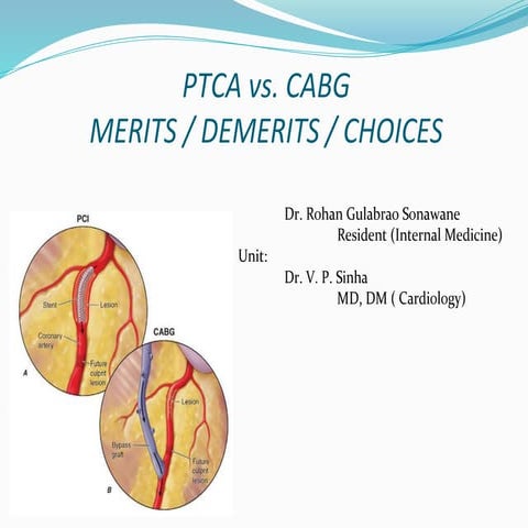 Ptca vs cabg | PPTX