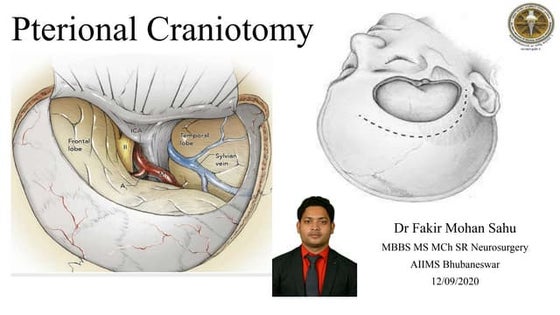 Aneurysm clips /clipology | PPT