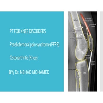 PT FOR KNEE DISORDERS Patellofemoral pain syndrome (PFPS ...
