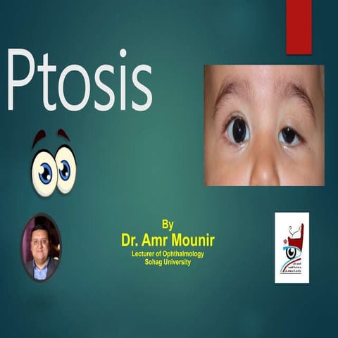 Ptosis | PPTX