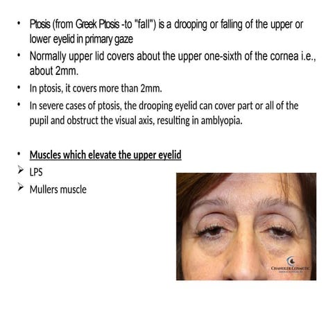 Case of ptosis and it’s diagnosis and management | PPT