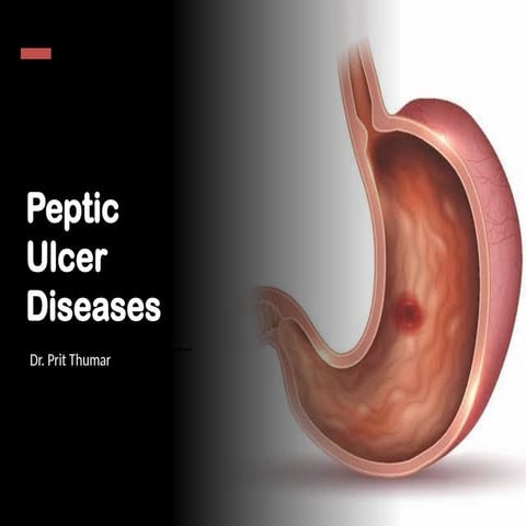 Peptic Ulcer Diseases With it's Management by Dr.Prit Thumar.pptx