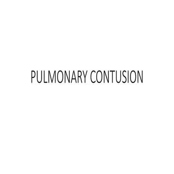 Pulmonary contusion | PPTX