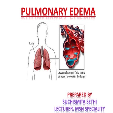 Pulmonary Edema Sympathetic Crashing Acute Pulmonary Edema Following