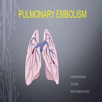 Pulmonary embolism | PPT