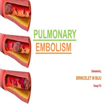 Pulmonary embolism | PPTX | Heart and Cardiovascular Diseases ...