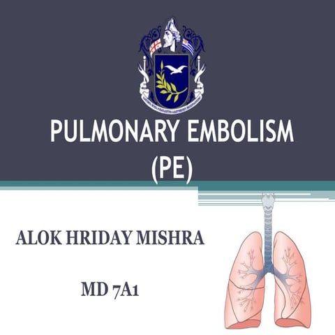 Everything about Pulmonary embolism- PPT | PPT