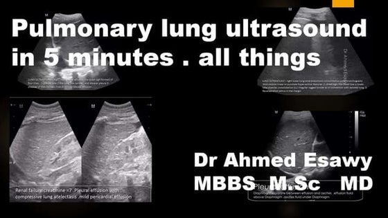 Thoracic Ultrasound For Diagnosing Pulmonary Embolism | PPT