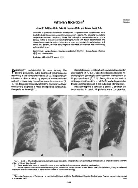 CONSOLIDATION poster in radiologyy .pptx