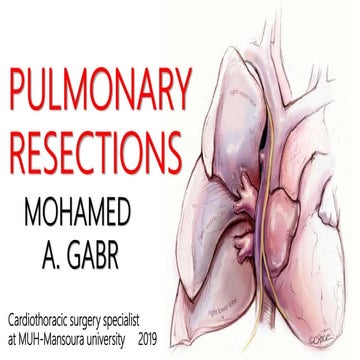 Pulmonary resections | PPTX
