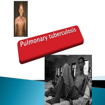 Pulmonary TB (Tuberculosis) PPT SlideShare | PPTX