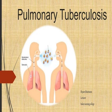 Pulmonary tuberculosis | PPTX