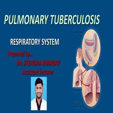 PULMONARY TUBERCULOSIS SLIDESHARE | PPTX