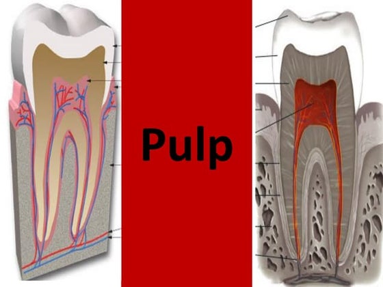 Anatomy of pulp chamber | PPTX | Dental Health | Diseases and Conditions