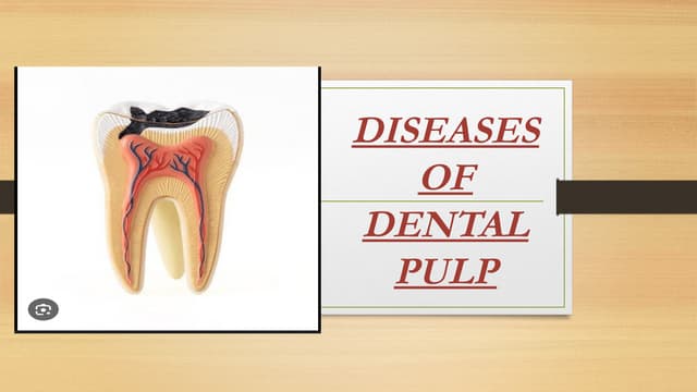 Pulpitis | PPTX