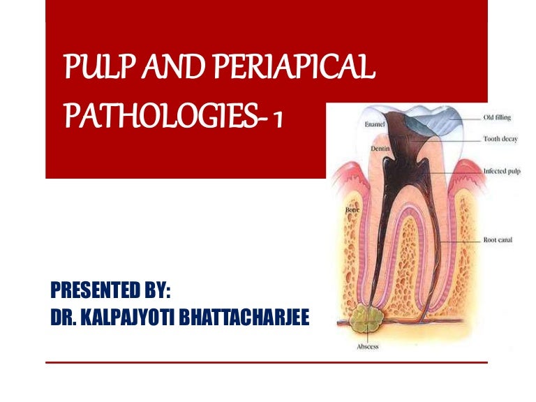 PULP AND PERIAPICAL LESIONS OF THE TOOTH ppt