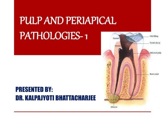 Periapical Abscess.pptx