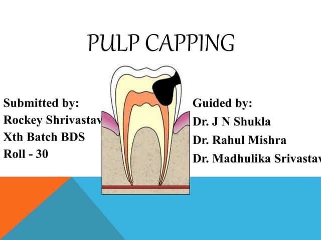 Direct and Indirect pulp capping | PPTX