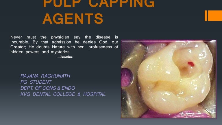 Pulp capping agents