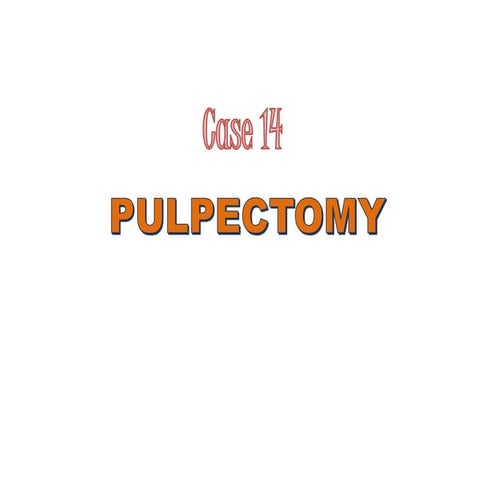 Pulpectomy | PPTX