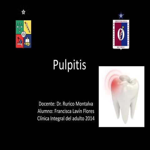 Pulpitis Aguda. Diagnostico | PPTX