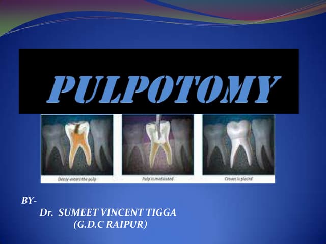CVEK,S PULPOTOMY | PPTX