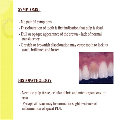 Periapical Abscess.pptx