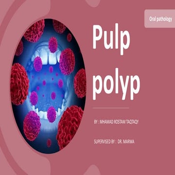 Pulp polyp | PPTX