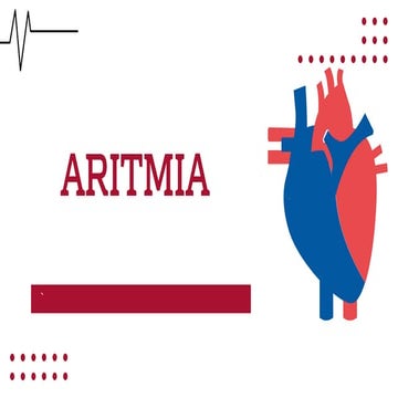Aritmia | PPTX