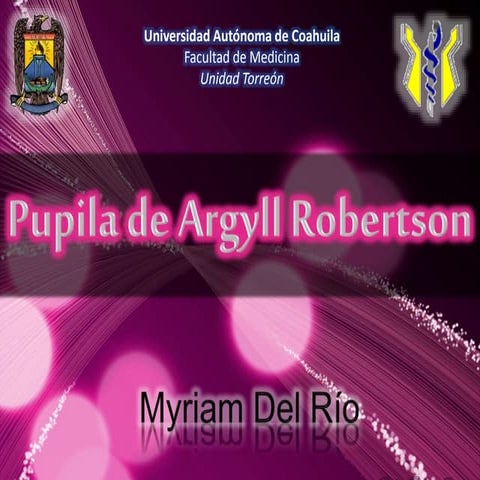Pupila de Argyll Robertson | PPSX
